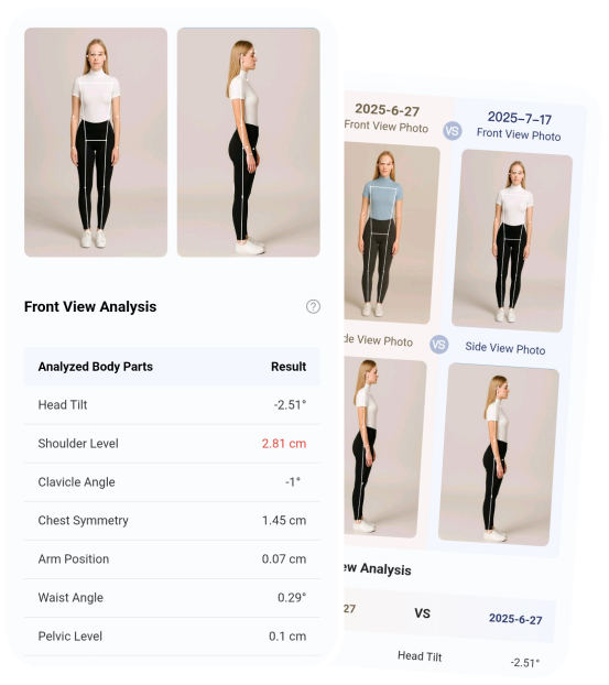 PoseAlign – AI Posture Screening App | Instant Posture Analysis